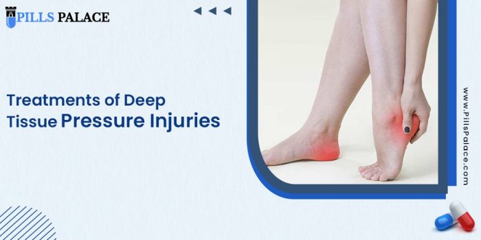 Treatments of deep tissue pressure injuries